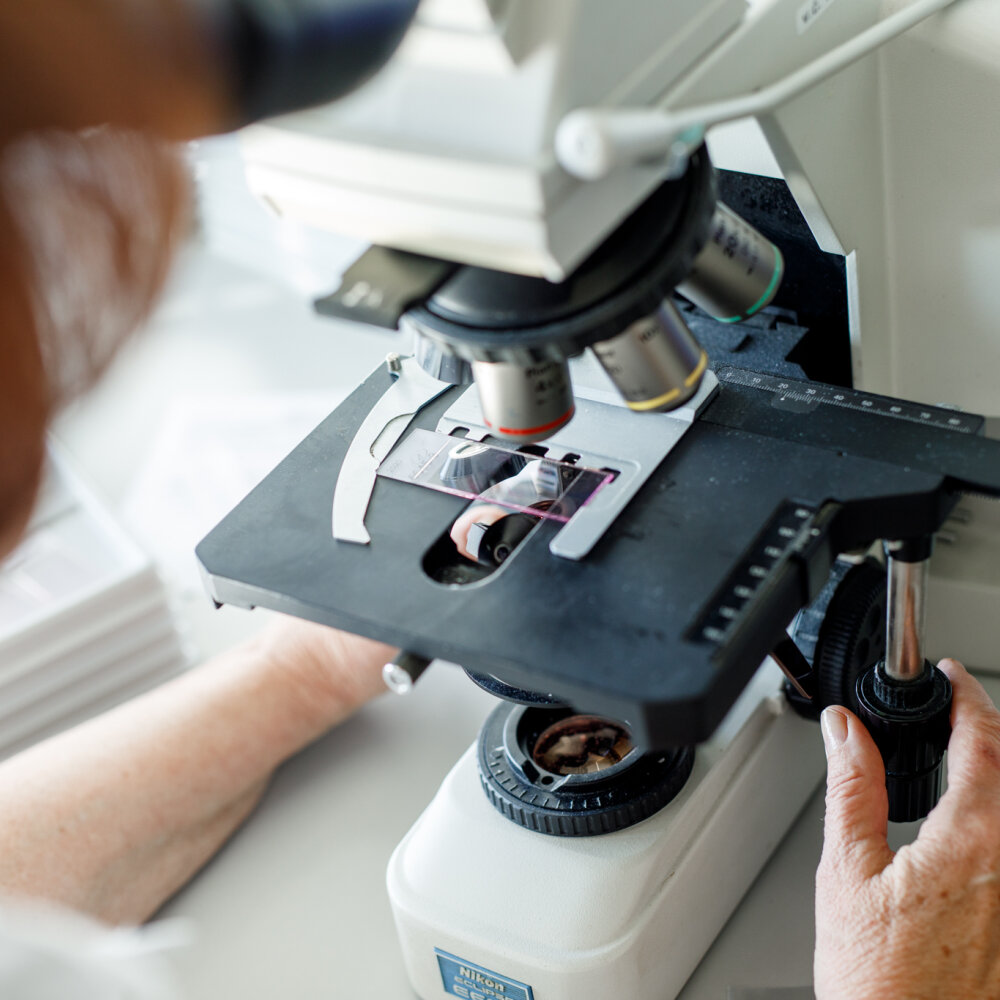 Biopsie / Masarykův onkologický ústav Brno